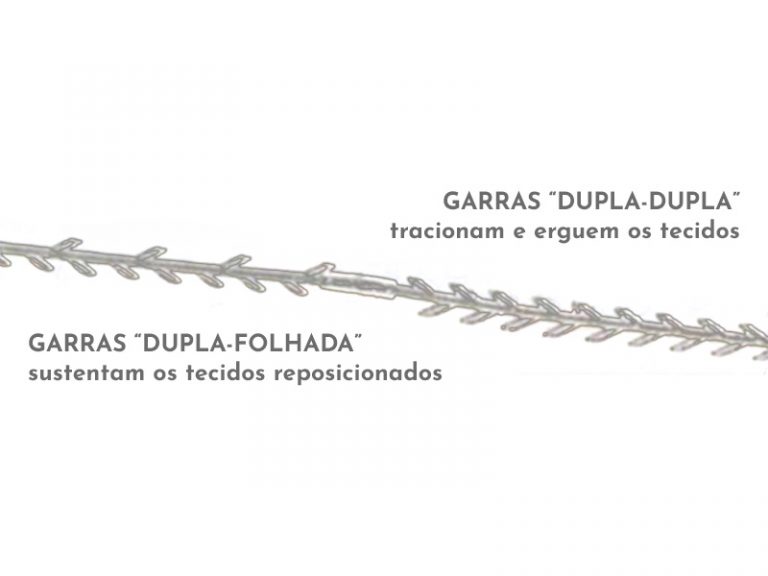 Fio Russo – Clínica de Olhos Dr. Levi Madeira